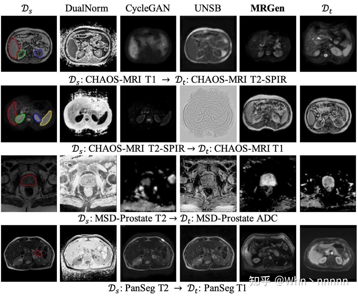 [ICCV 2025] MRGen: 针对稀缺MRI模态的分割数据生成引擎 - 知乎