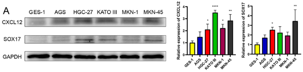 从临床问题切入，分析壁外血管侵犯(EMVI)和免疫相关基因！这篇8分+生信文章极具借鉴意义，还告诉你验证实验这么加更有价值~ - 知乎