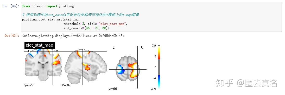 nilearn 笔记（5） - 知乎