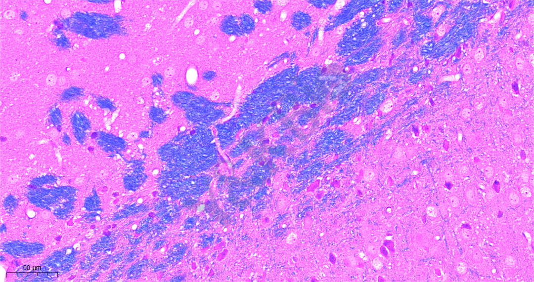 脑组织实验前处理方法及常做的染色 - 知乎