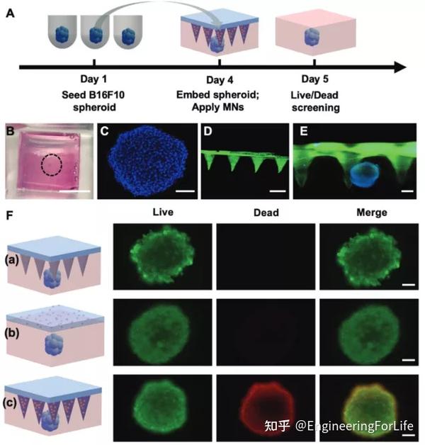 AHM：GelMA的综合运用——微针贴片+肿瘤模型 - 知乎