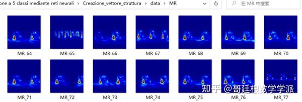 基于连续小波变换和GoogLeNet的PCG心音信号分类算法 - 知乎