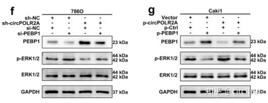 Mol Cancer | 陈明联合团队发现circPOLR2A通过泛素化途径调控ERK信号参与肾透明细胞癌 - 知乎