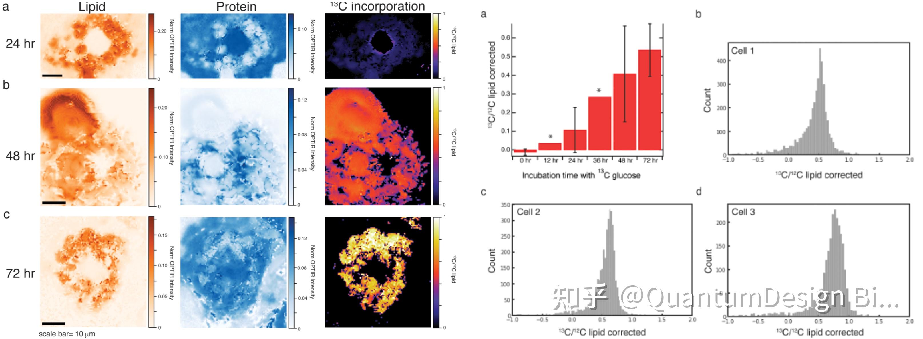耶鲁大学新进展！探索活细胞脂肪代谢过程：光学红外显微成像技术揭开DNL的奥秘 - 知乎