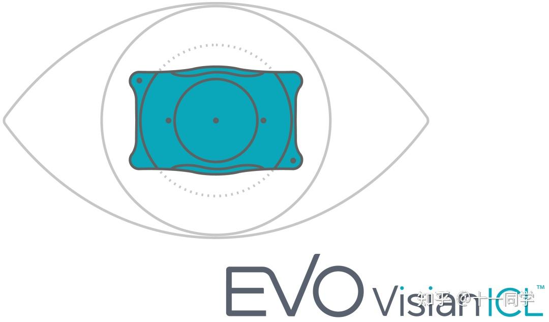 ICL晶体植入为什么比激光手术贵？ - 知乎