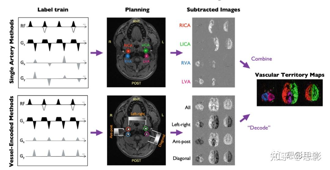 ASL 的最新技术发展：对最新技术的回顾 - 知乎