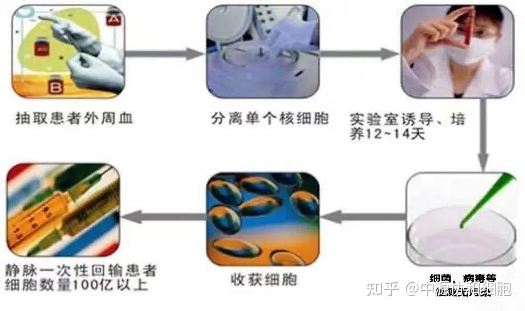 抗癌四大法宝：CIK细胞、DC细胞、NK细胞、CTL/TCR,你分得清吗？ - 知乎