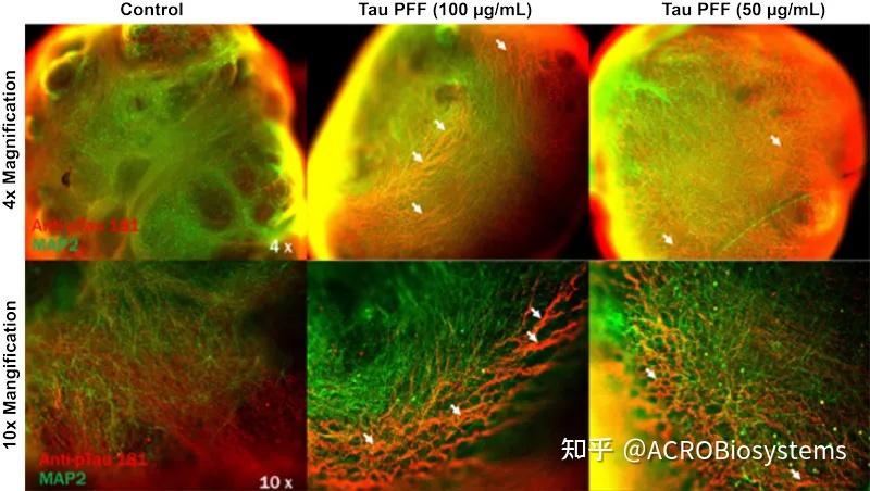 预制前体纤维（PFFs）在神经退行性疾病中的应用 - 知乎