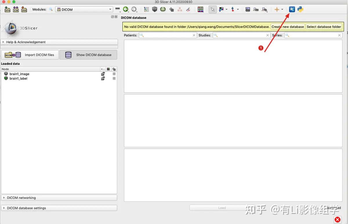 使用3D Slicer软件提取影像组学特征-影像组学（radiomics）小李教学系列视频笔记 - 知乎
