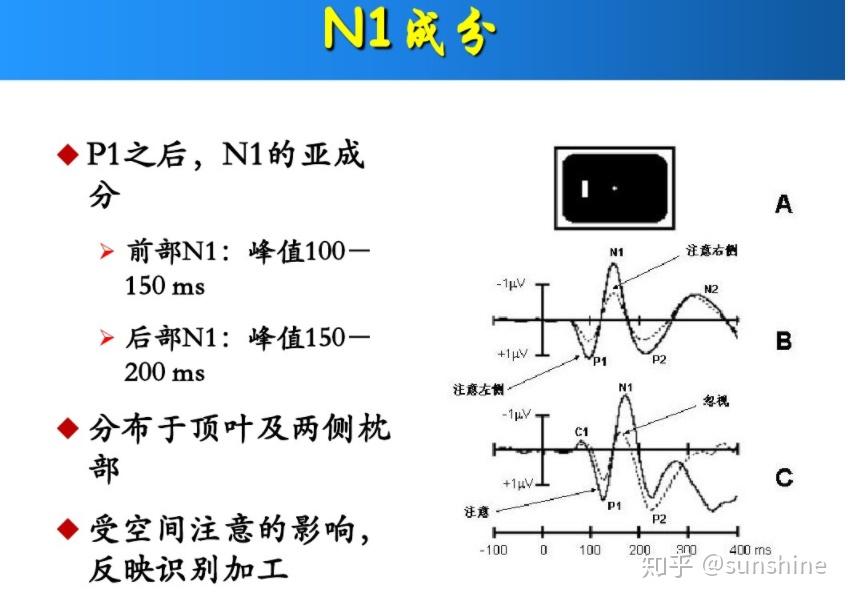 ERP成分（N1/P2/N400） - 知乎