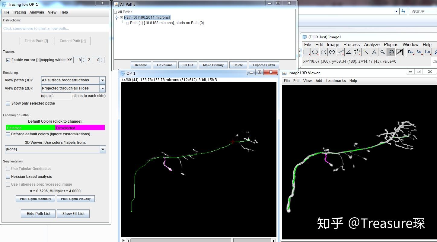 ImageJ实用技巧——Simple Neurite Tracer(插件篇) - 知乎