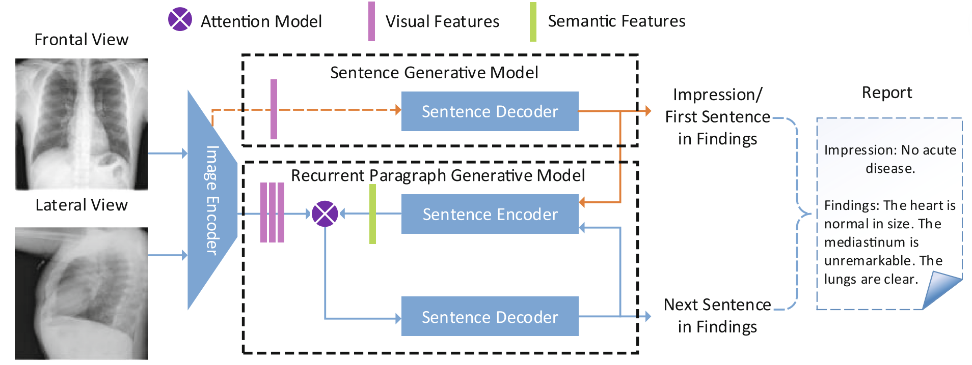 [论文笔记]Multimodal Recurrent Model with Attention for Automated Radiology ...
