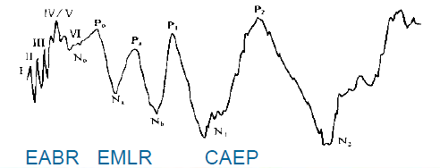 临床听力学技术专业沙龙 | 鲁兆毅：电刺激听觉诱发电位在人工耳蜗植入中的应用 - 知乎