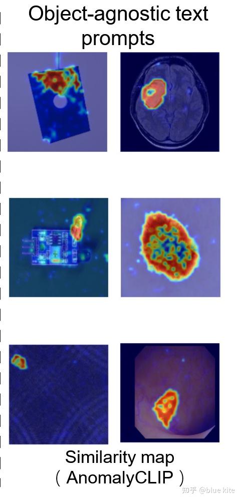 【零样本异常检测】AnomalyCLIP: OBJECT-AGNOSTIC PROMPT LEARNING FOR ZERO-SHOT ANOMALY DETECTION - 知乎