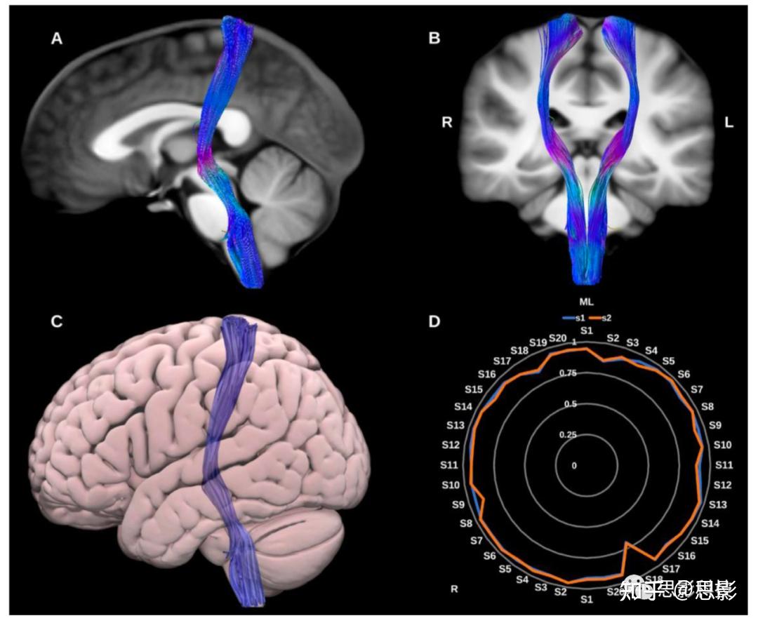 基于约束球面反卷积扩散磁共振的脑白质解剖图谱 - 知乎