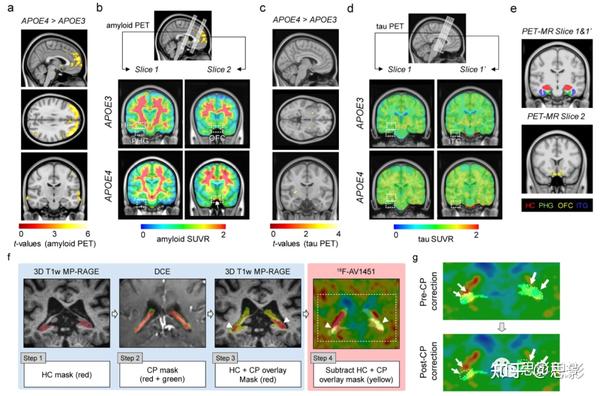 Nature：APOE4诱发血脑屏障功能障碍可预测认知功能下降 - 知乎