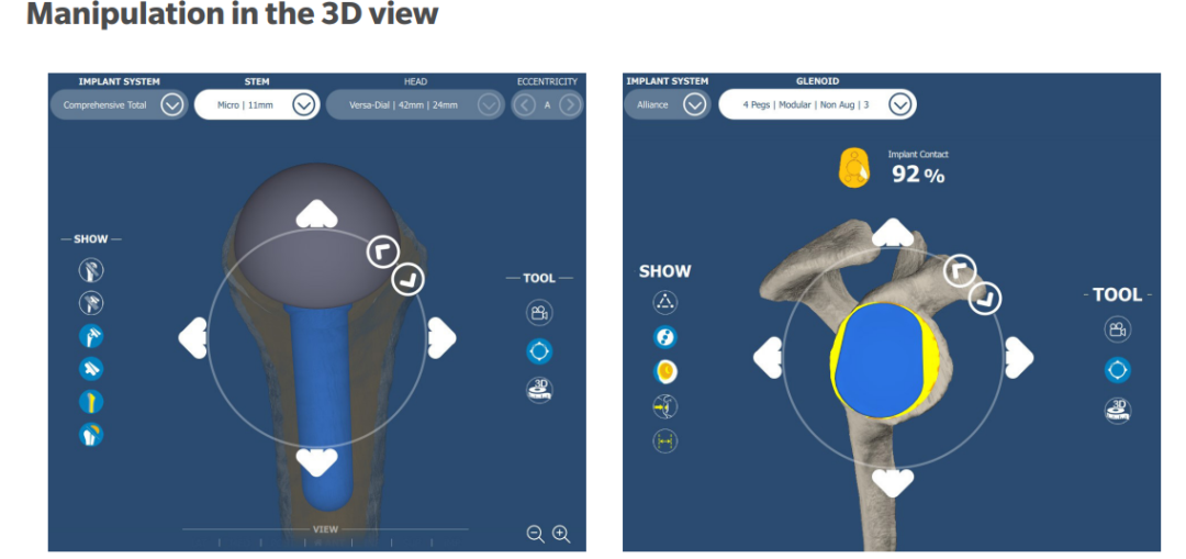 2024最值得关注的6款骨科手术机器人 | 盘点 - 知乎