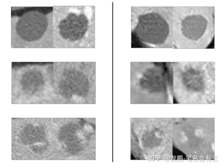 【每周CV论文推荐】GAN在医学图像生成中的典型应用 - 知乎