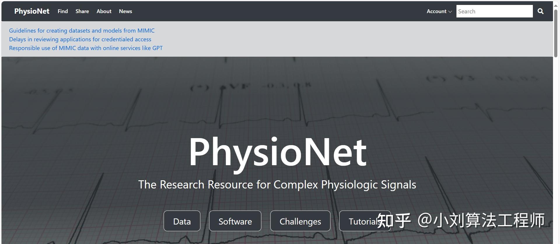 「ECG信号处理-第一课——认识MIT-BIH数据库」2024年10月25日 - 知乎