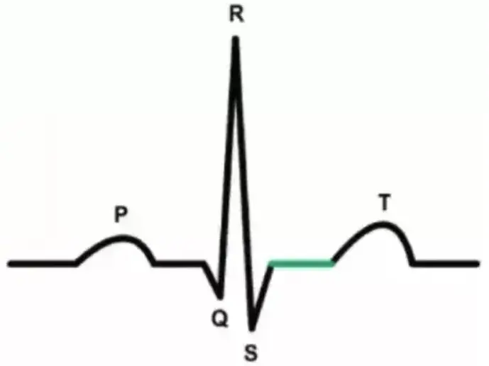 ECG心电信号采集与分析技术综述 - 知乎