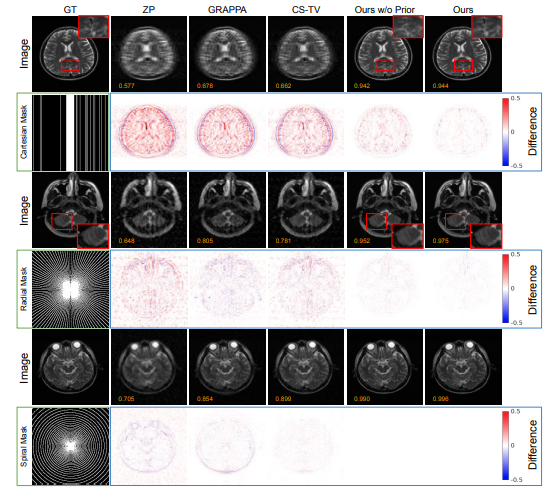 CVPR 2020 论文大盘点-医学影像处理识别篇 - 知乎