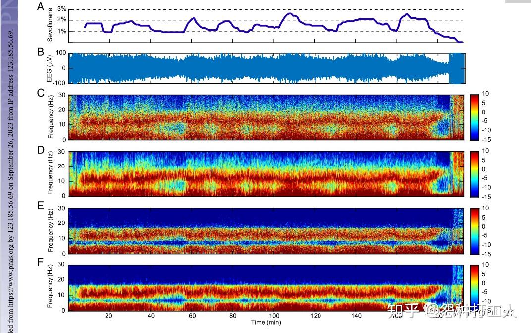 【时频分析】状态空间多锥时频分析【附MATLAB代码】 - 知乎