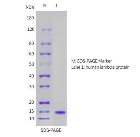 人Lambda蛋白 Human Lambda Protein - 知乎