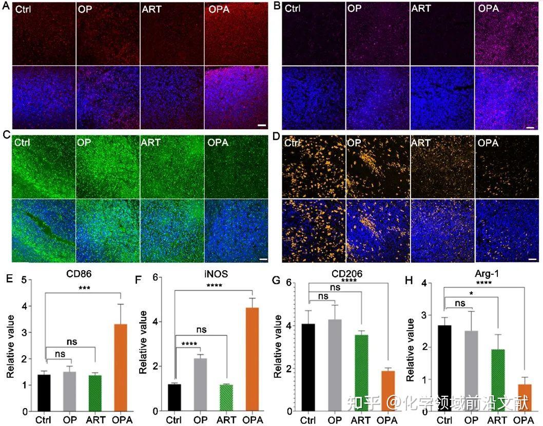 南京大学郭子建院士、王晓勇教授Angew.：以TREM2为靶标的铂类抗癌配合物通过重塑肿瘤微环境提高化学免疫治疗效果 - 知乎