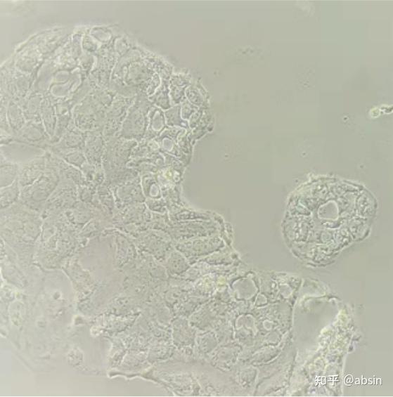 Caco-2细胞培养攻略 - 知乎