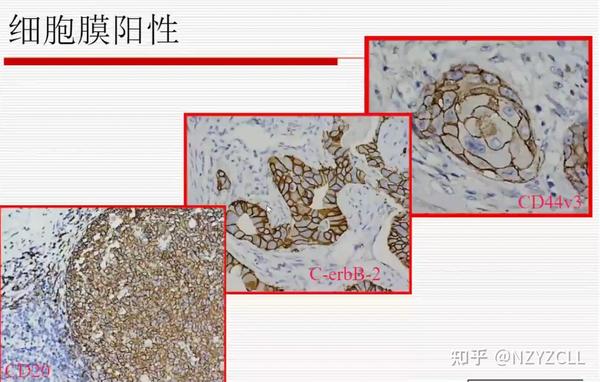 免疫组织化学实验IHC - 知乎
