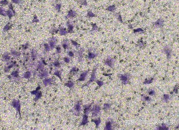 从青铜到王者，科研小白的进阶之路（5）——Transwell细胞侵袭实验教程 - 知乎