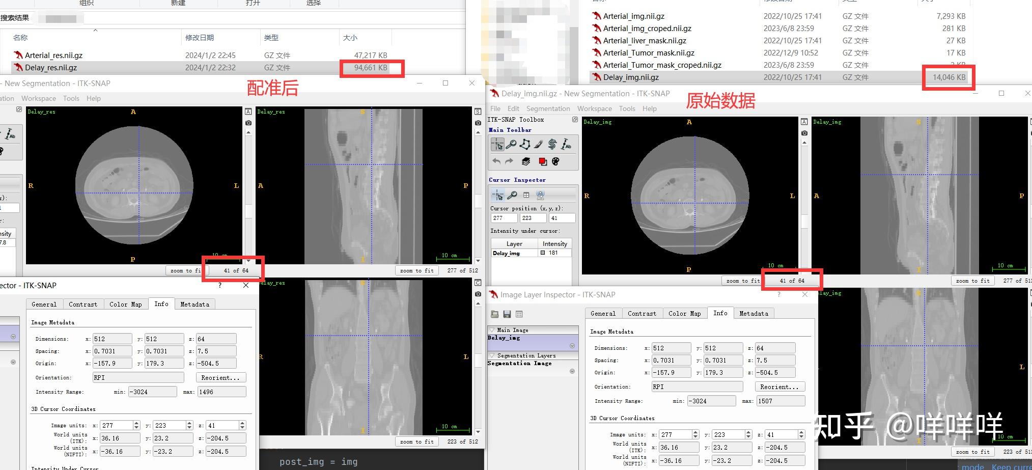 FSL用于脑部MRI图像配准: （flirt与ants刚性与弹性配准） - 知乎