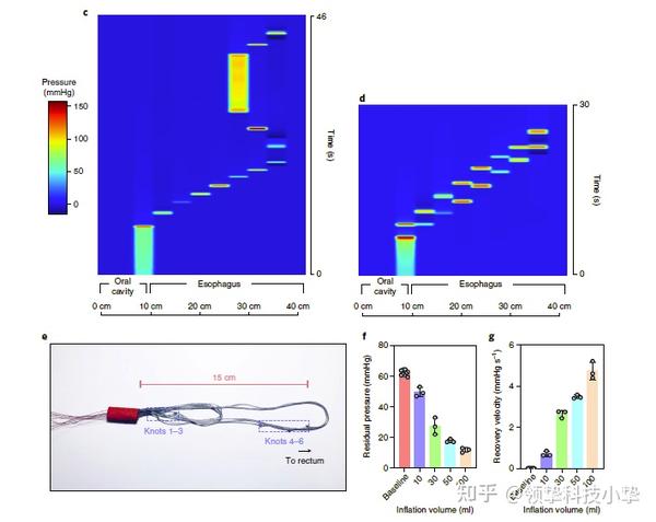 “挚盒01RC”巧遇伯乐“MIT南科望博士团队”——Nat. Bio. Eng. 报导便捷低成本的新型消化道测压仪！ - 知乎