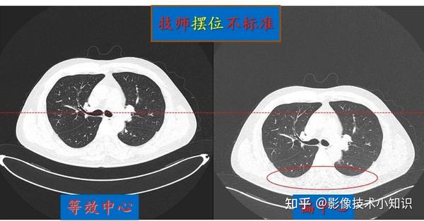 CT的扫描野和显示野 - 知乎