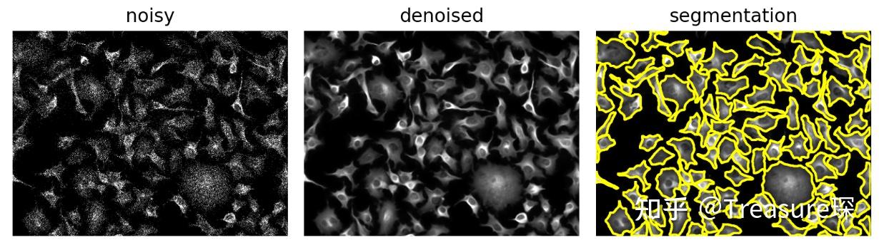 Cellpose 3.0 —— 一键图像恢复+细胞分割 - 知乎