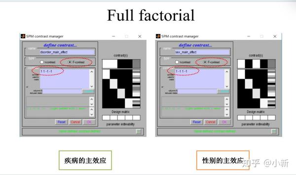 13-SPM-fmri任务态 二阶分析：多因素方差分析 - 知乎