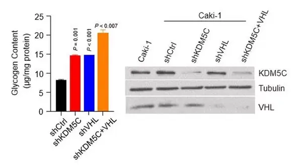 肾透明细胞癌致瘤机制：KDM5C基因缺失致使糖原代谢重编和抑制铁死亡 - 知乎