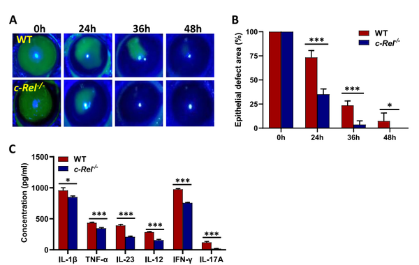 Inflamm Regen︱山东第一医科大学附属山东省眼科研究所阮庆国团队利用外泌体介导的靶向NF-κB c-Rel策略促进角膜损伤修复 - 知乎