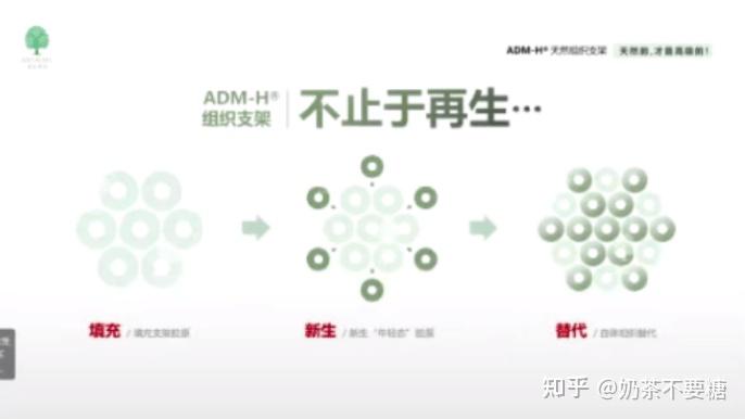 悦己，按下岁月的暂停键 —将ADM-H融入生活 - 知乎