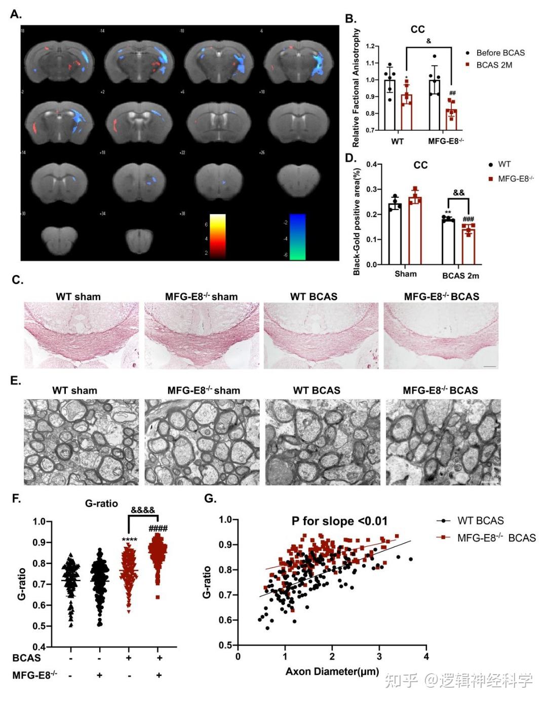 Neurosci Bull︱南京大学徐运/陈妍团队揭示MFG-E8通过吞噬髓鞘碎片改善慢性脑缺血相关认知障碍 - 知乎