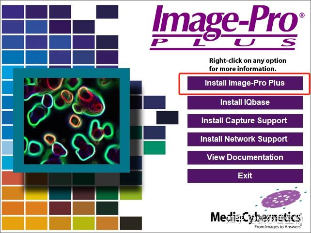 ImageJ？Fiji？Image pro plus？图像处理哪家强？ - 知乎