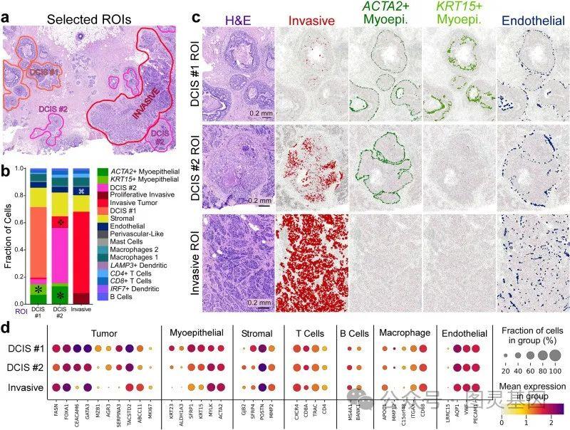 Nat Comm | 10x Genomics团队用单细胞、空间和原位分析技术联合绘制高分辨率肿瘤微环境图谱 - 知乎