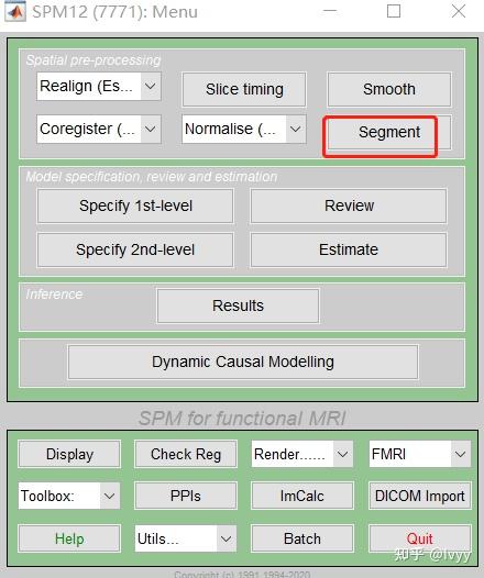 SPM数据预处理 -单被试 - 知乎