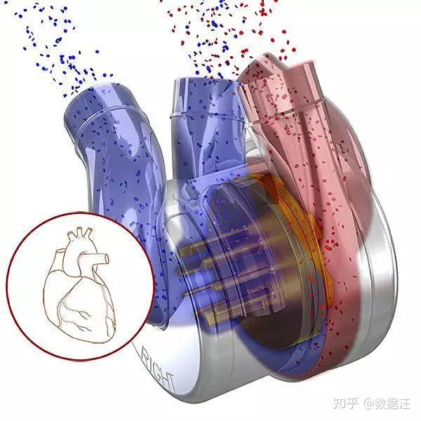 18年一剑！德州心脏研究所研制出磁悬浮心脏，每秒2000转，为心衰患者续命 - 知乎