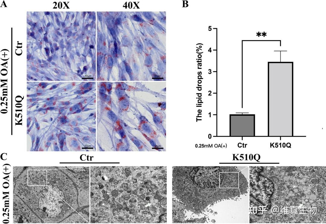 渐冻症研究新进展——FUS基因突变导致骨骼肌脂代谢紊乱！ - 知乎