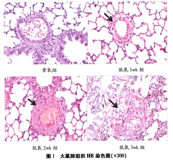 文献解读：重视慢性高原病！低氧性肺动脉高压(HPH)危害多（HPH大鼠模型构建流程） - 知乎