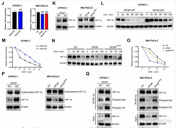 Cancer research | MTAP缺失诱导的代谢重塑增加胰腺癌嘌呤从头合成和糖酵解共靶向敏感性 - 知乎