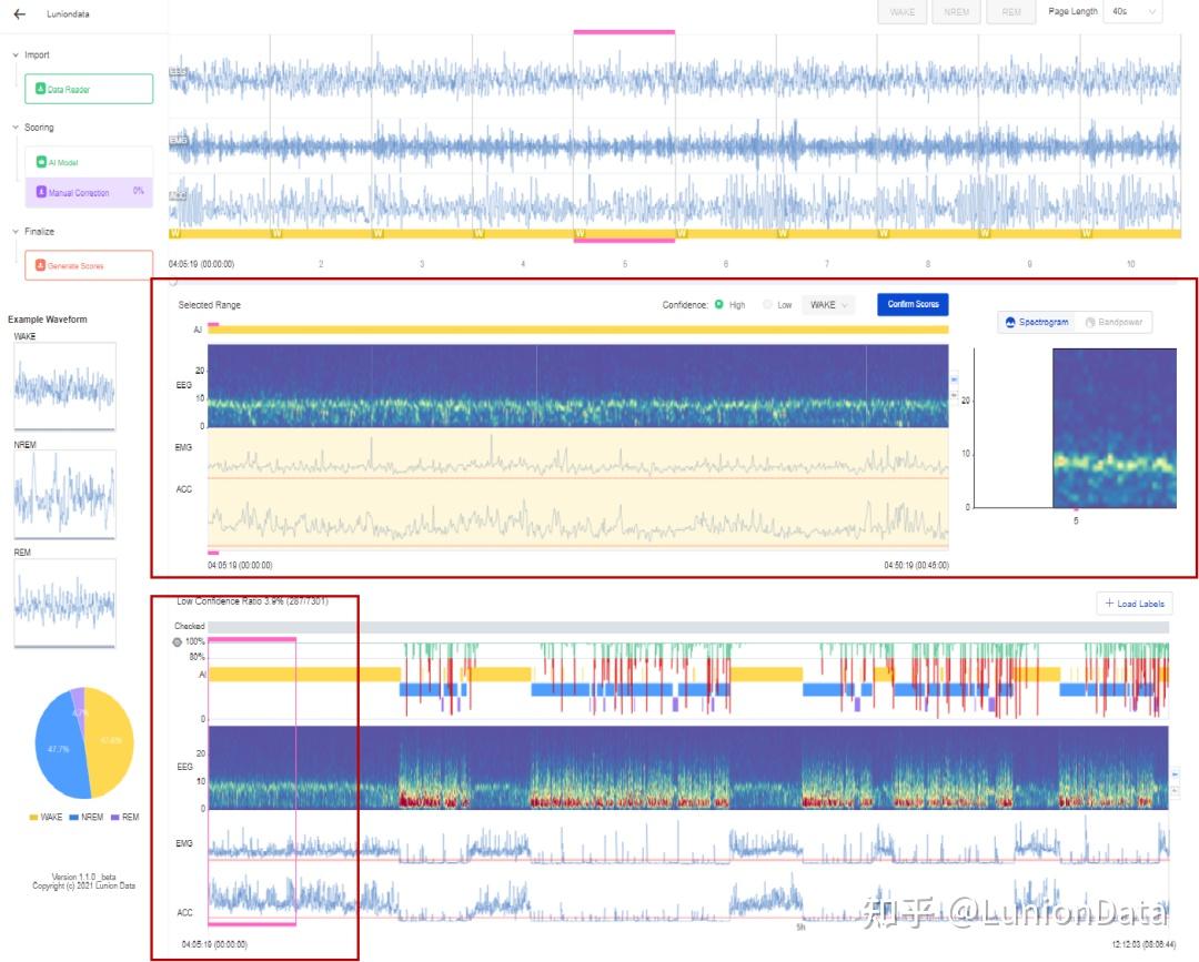 睡眠分期 | Lunion Stage 2分钟视频教程 - 知乎