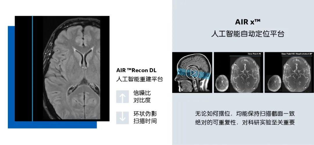正式发布！SIGNA™ 7T引领科研 共创精准转化 - 知乎