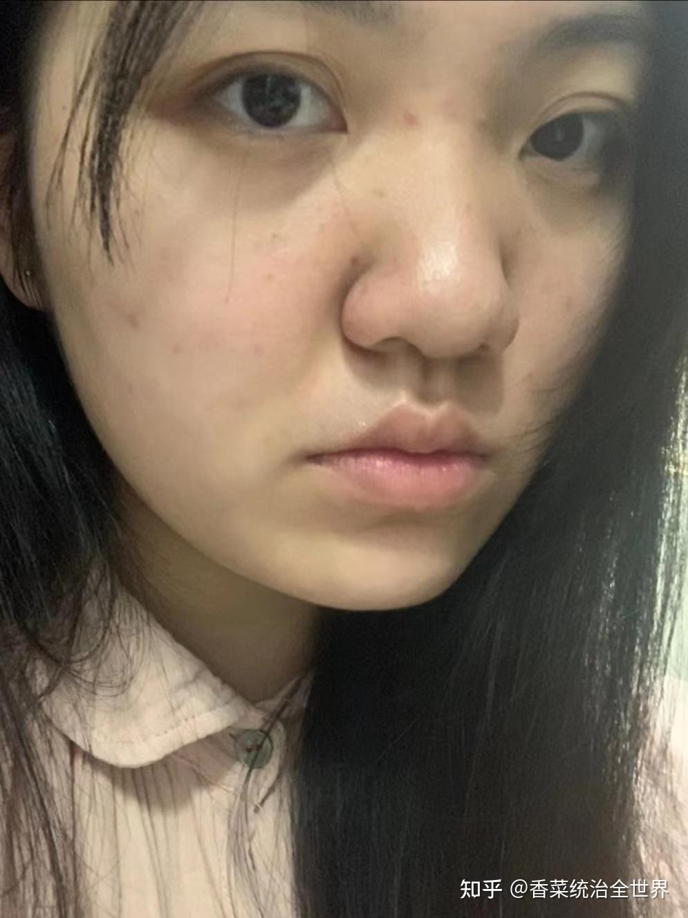 眼周暗沉，黑眼圈重到遮暇都盖不住，有解决黑眼圈很牛的方法吗？ 知乎